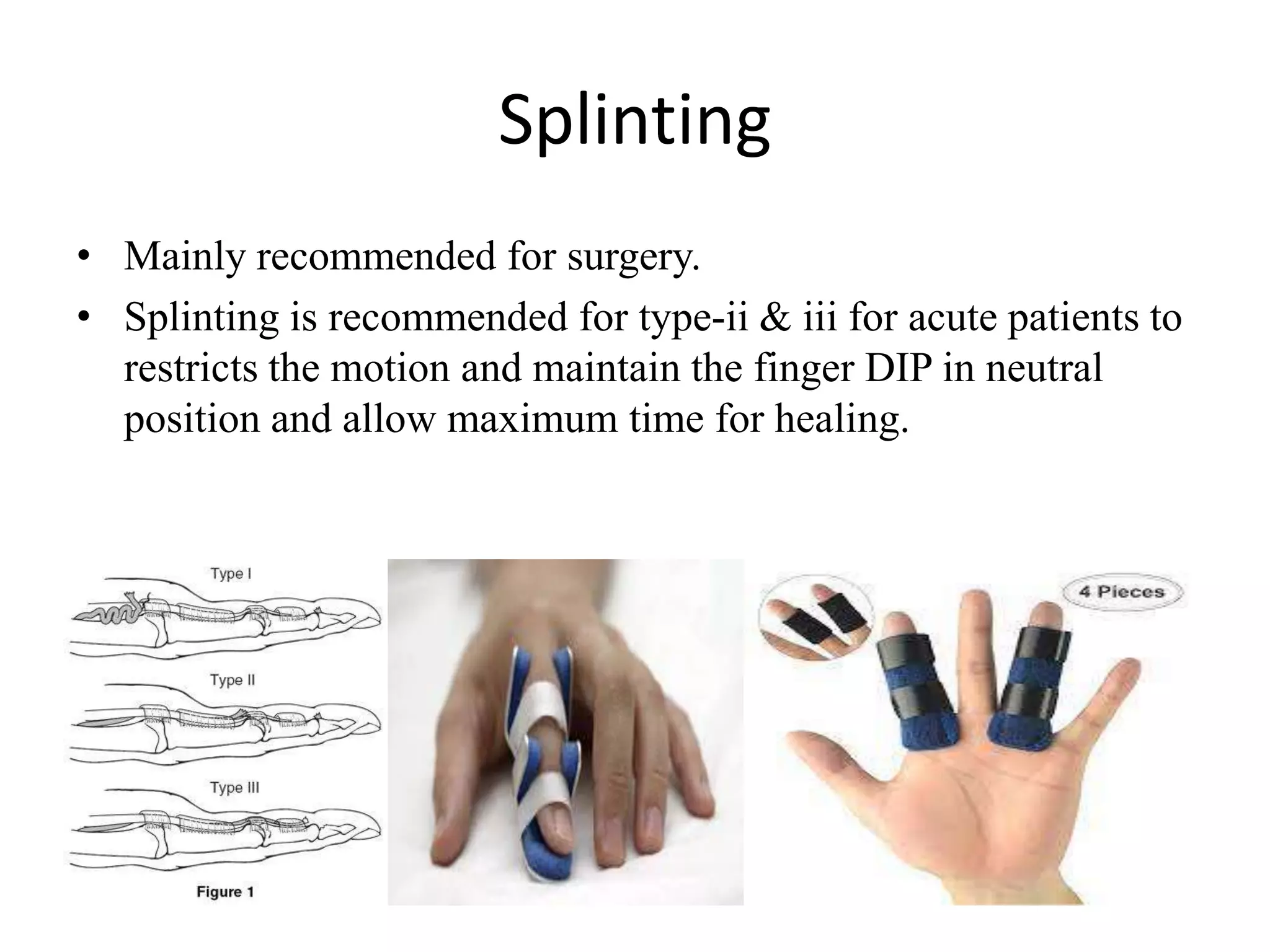 Hand splinting in common orthopedic & neurological condition 1 | PPTX
