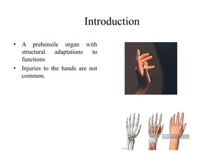 Bishops Hand Deformity