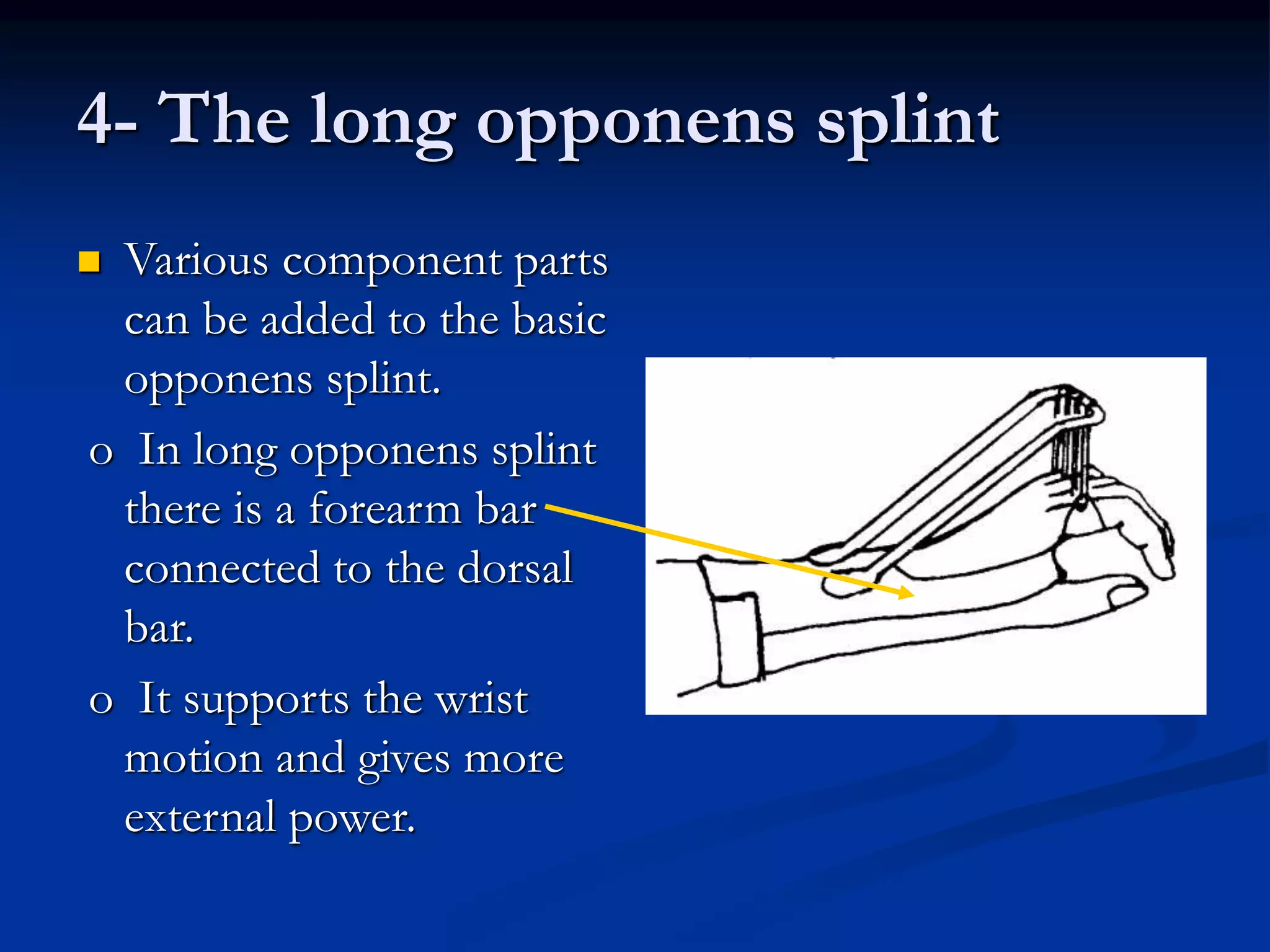 Hand splints | PPT
