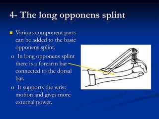 Hand splints | PPT
