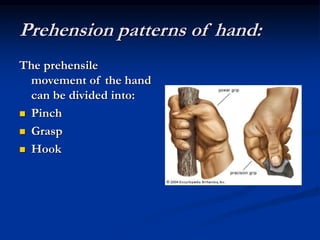 Hand splints | PPT