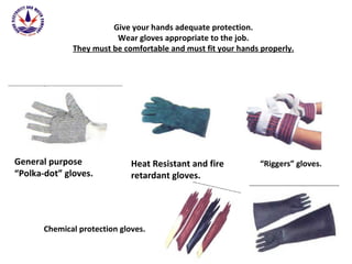 Hands & tools safety copy | PPT | First Aid | Injuries