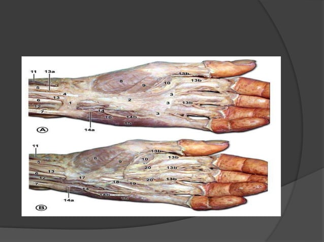 Detailed Hand surgical anatomy by mohamed abdelhady | PPTX | Death ...
