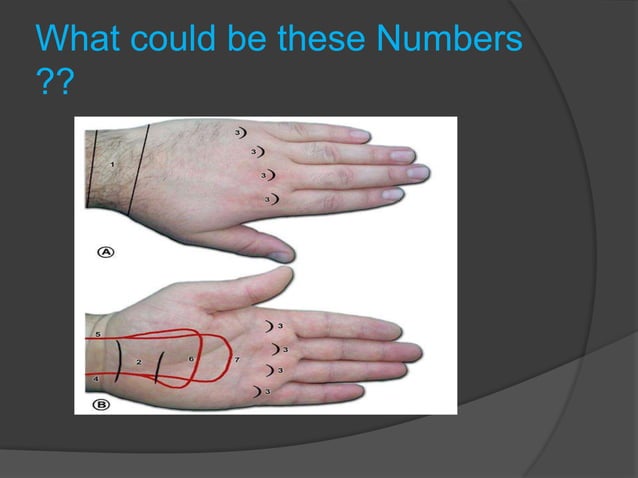 Detailed Hand surgical anatomy by mohamed abdelhady | PPTX | Death ...