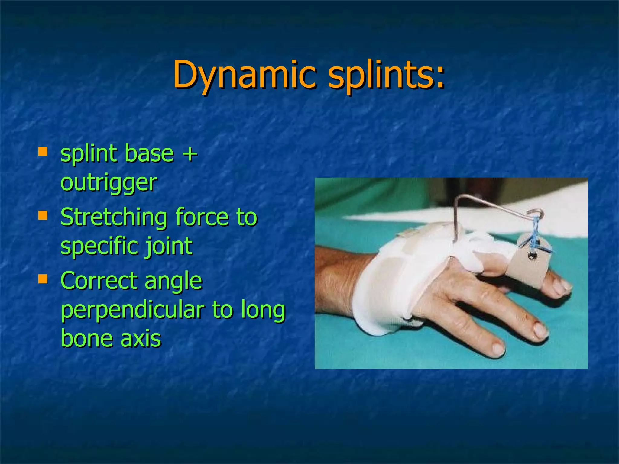 Hand Therapy - Stiff Small Joints Of The Fingers | PPT