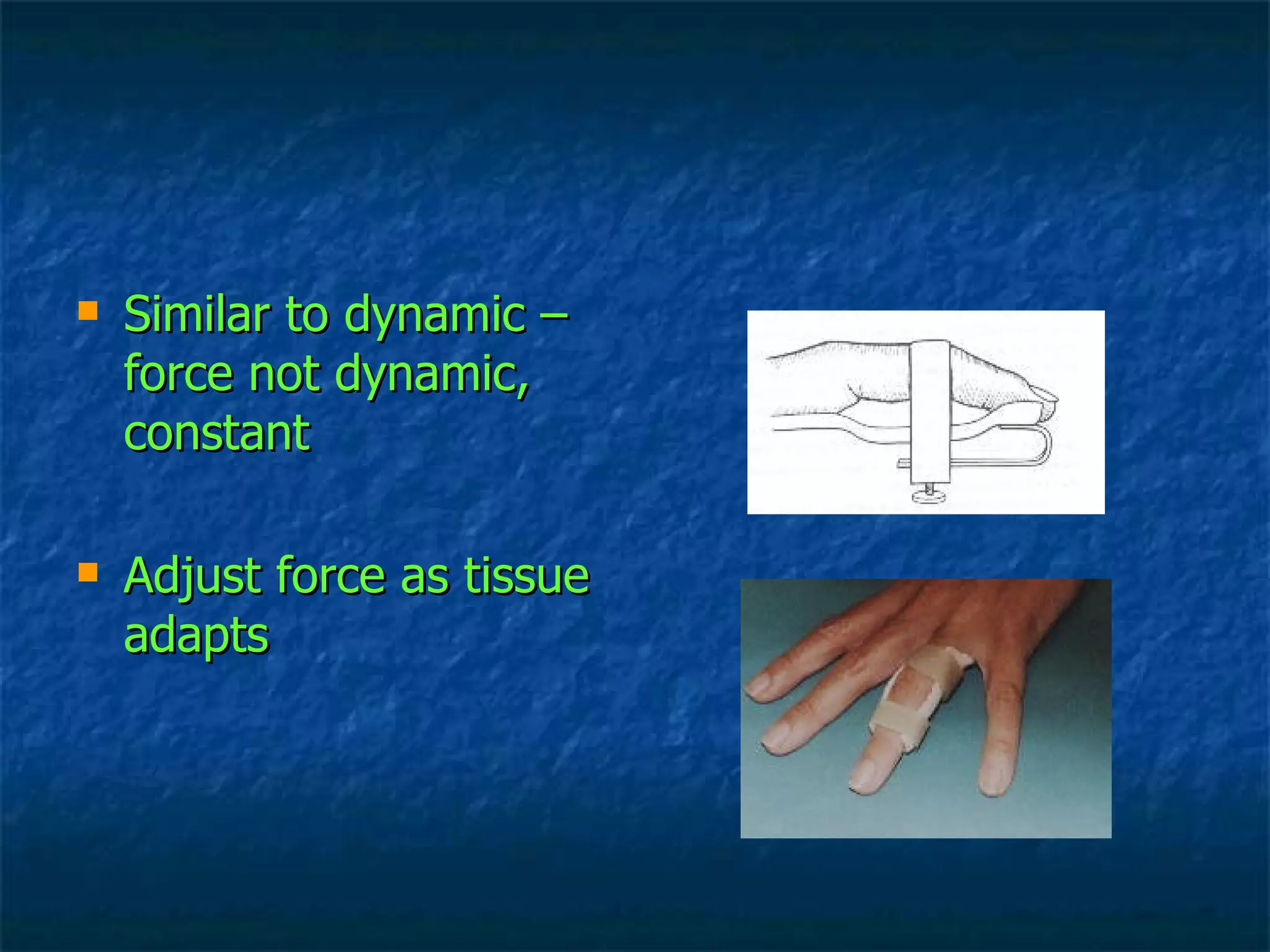 Hand Therapy - Stiff Small Joints Of The Fingers | PPT