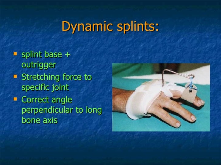 What Is A Serial Static Splint - spicegop