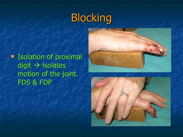 Hand Therapy - Stiff Small Joints Of The Fingers
