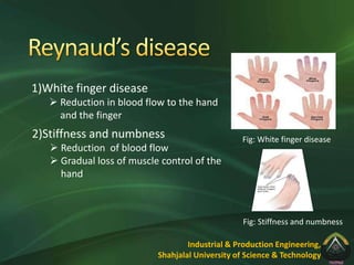 Hand tool design for ergonomics | PPTX