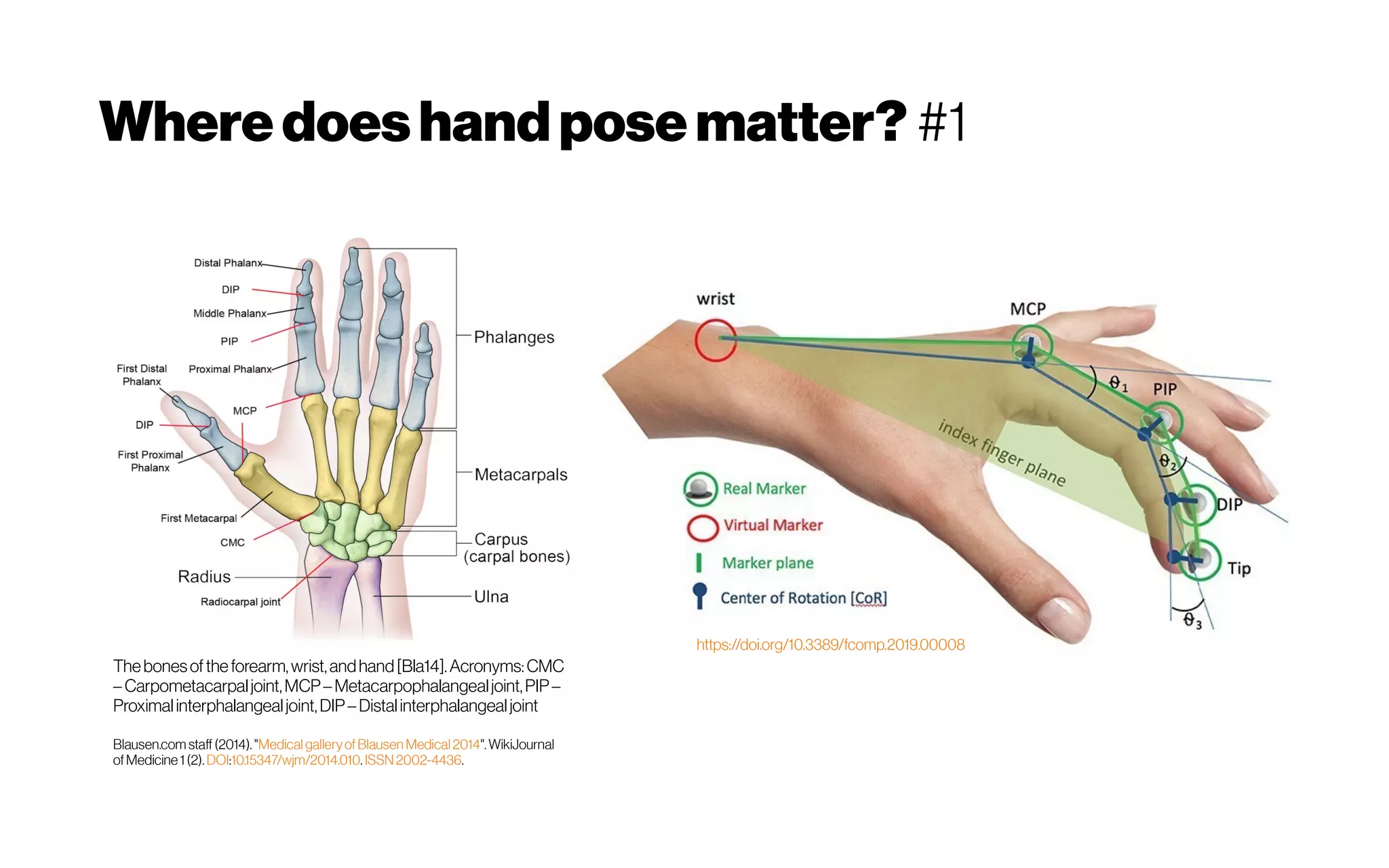 Hand Pose Tracking for Clinical Applications | PDF | Wearable ...