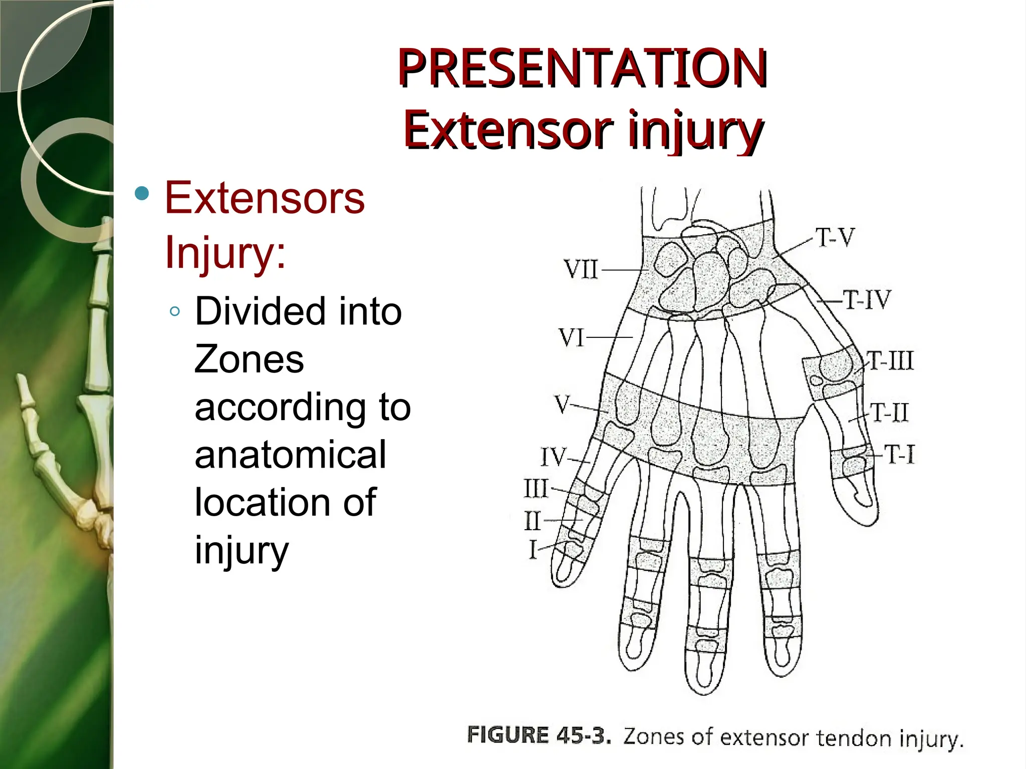 HandTrauma-1_0(1) at manufacturing company.ppt