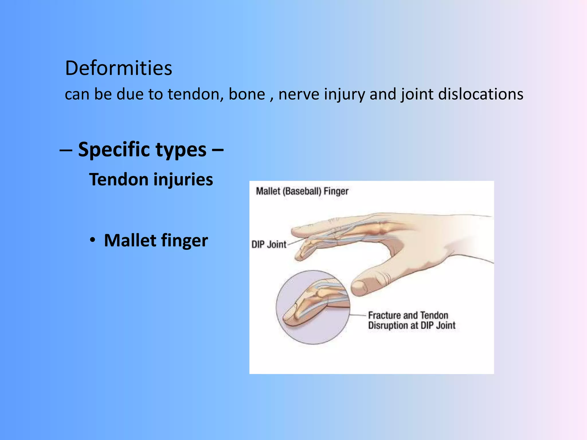 Hand trauma - soft tissue injuries overview ,principles of management ...