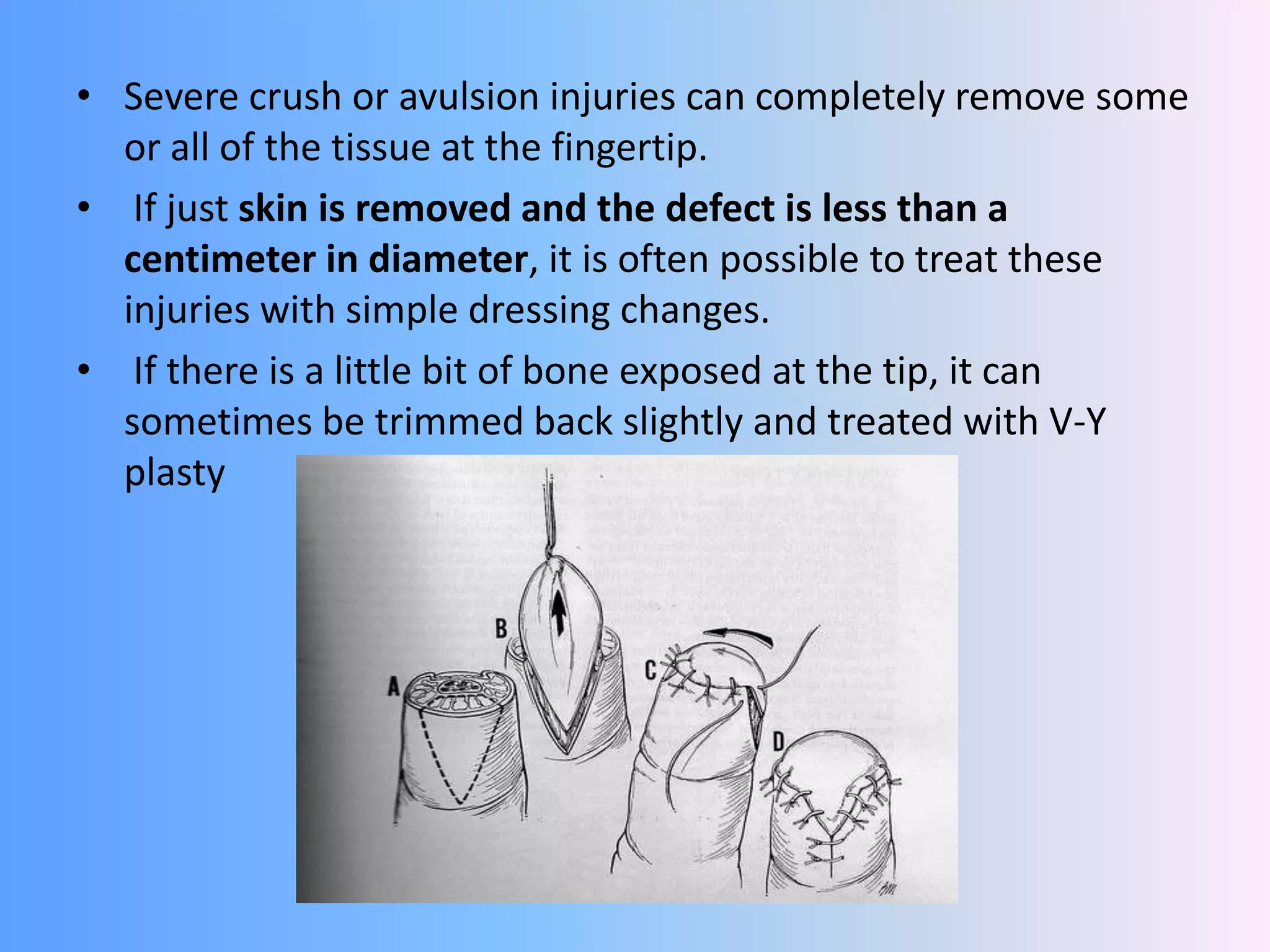 Hand trauma - soft tissue injuries overview ,principles of management ...