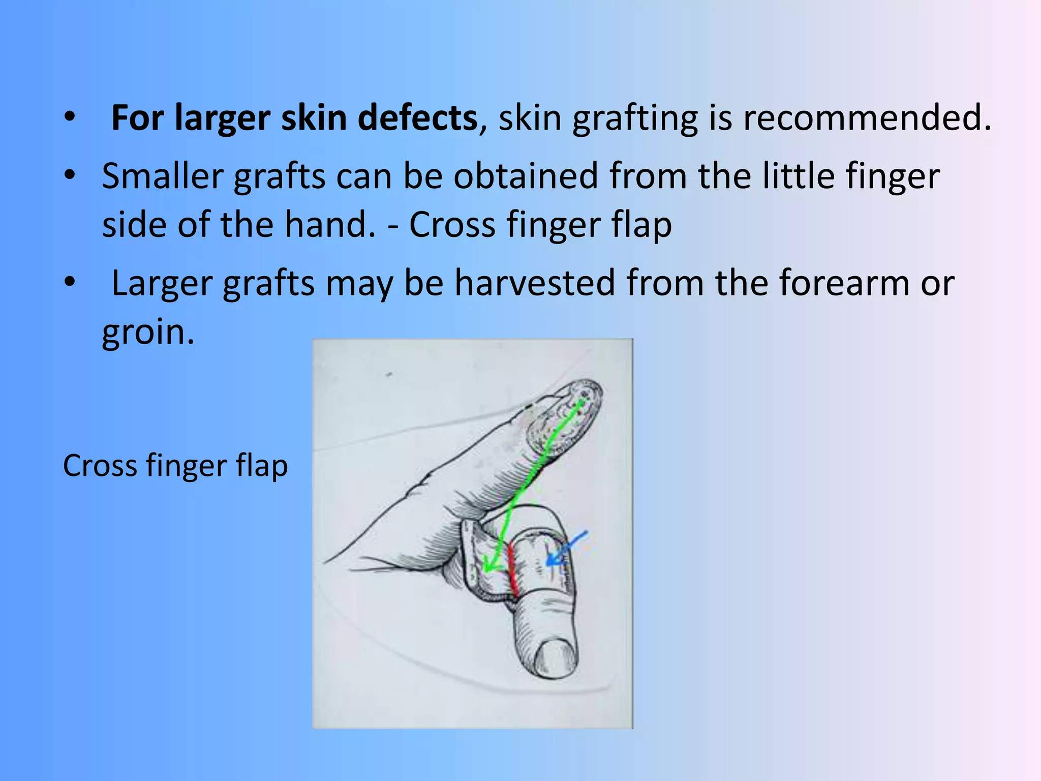 Hand trauma - soft tissue injuries overview ,principles of management ...
