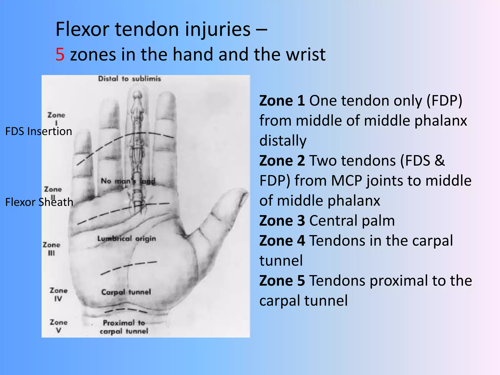 Hand trauma - soft tissue injuries overview ,principles of management ...