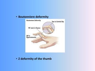 Hand trauma - soft tissue injuries overview ,principles of management ...