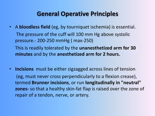 Hand trauma - soft tissue injuries overview ,principles of management ...