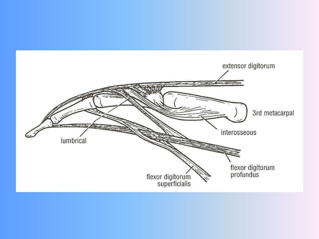 Hand trauma - soft tissue injuries overview ,principles of management ...