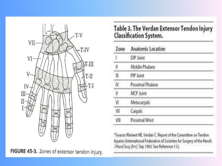 Hand trauma - soft tissue injuries overview ,principles of management