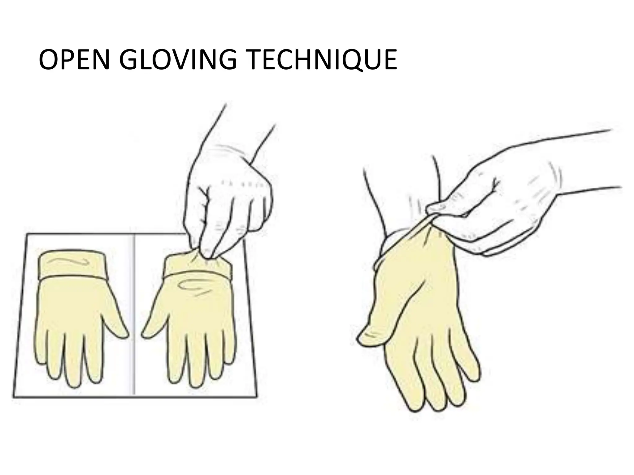 handwashing for operation theater and surgical scrubbing | PPTX