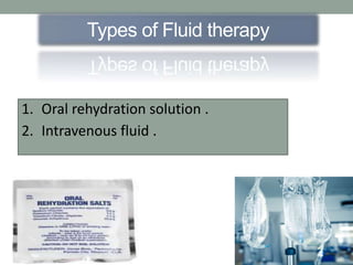 Fluid therapy in pediatrics/ oral dehydration solution/Dehydration. | PPTX