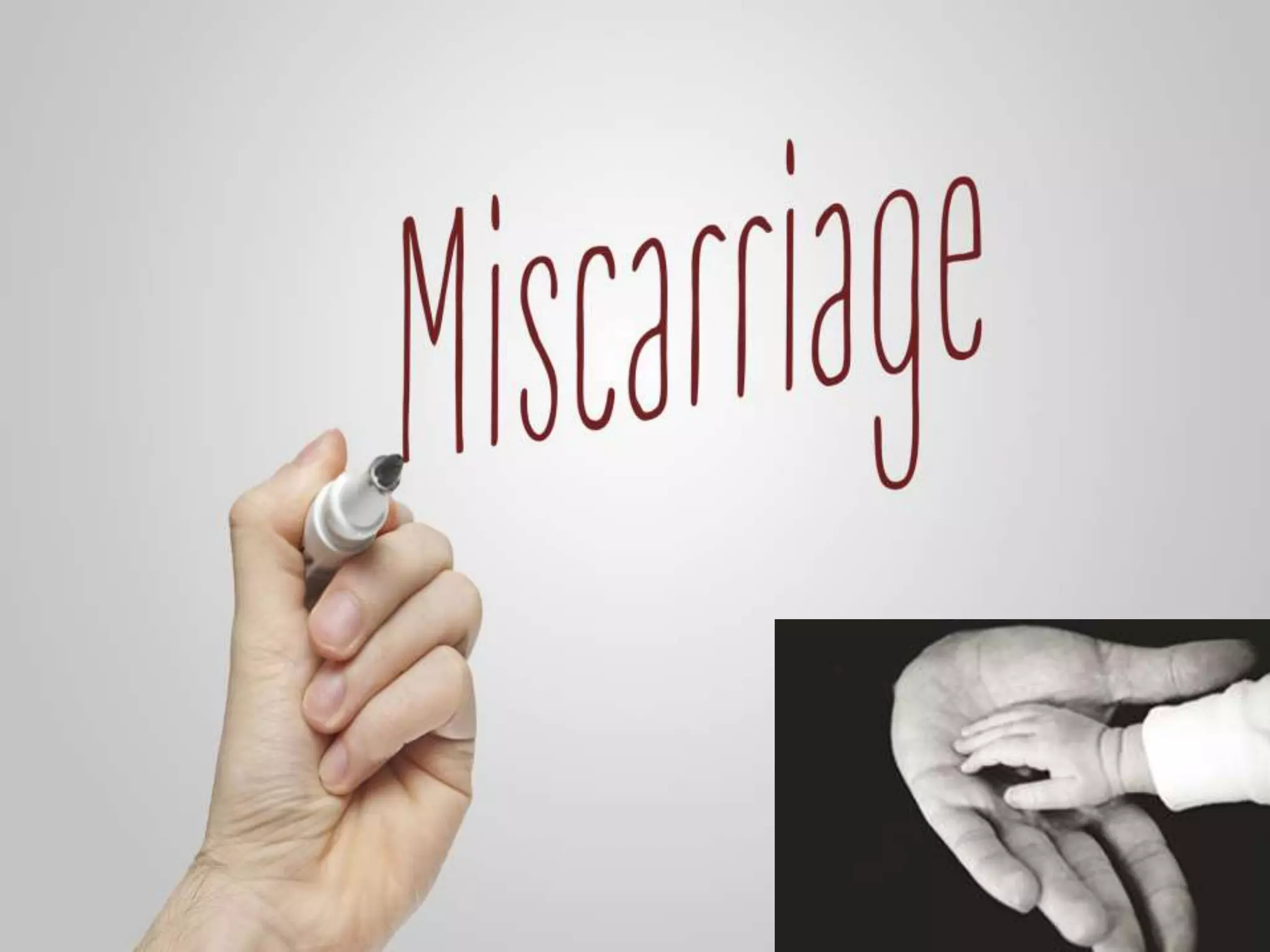 early pregnancy bleeding/ miscarriage types and management. | PPTX