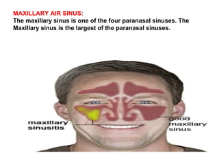 anatomy of Paranasal sinus | PPT