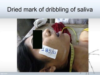 hanging-245345563367650765788665782.pptx