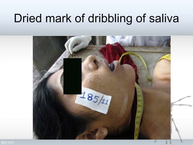 hanging-245345563367650765788665782.pptx | First Aid | Injuries