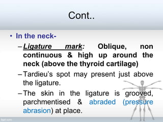 hanging-245345563367650765788665782.pptx