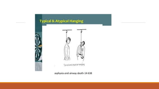 HANGING.pptx