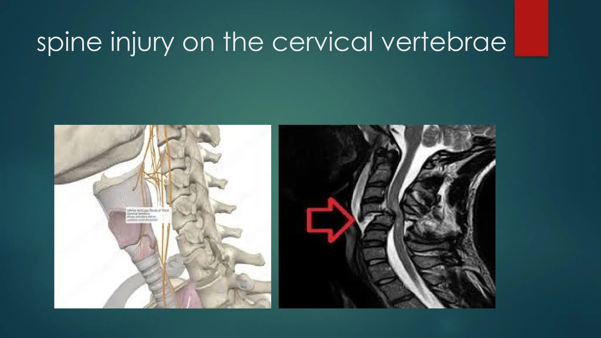 HANGING IN HISTOPATHOLOGY BY STEPHEN ANTO.pptx