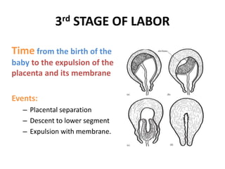 Complications of 3rd Stage of Labor | PPTX