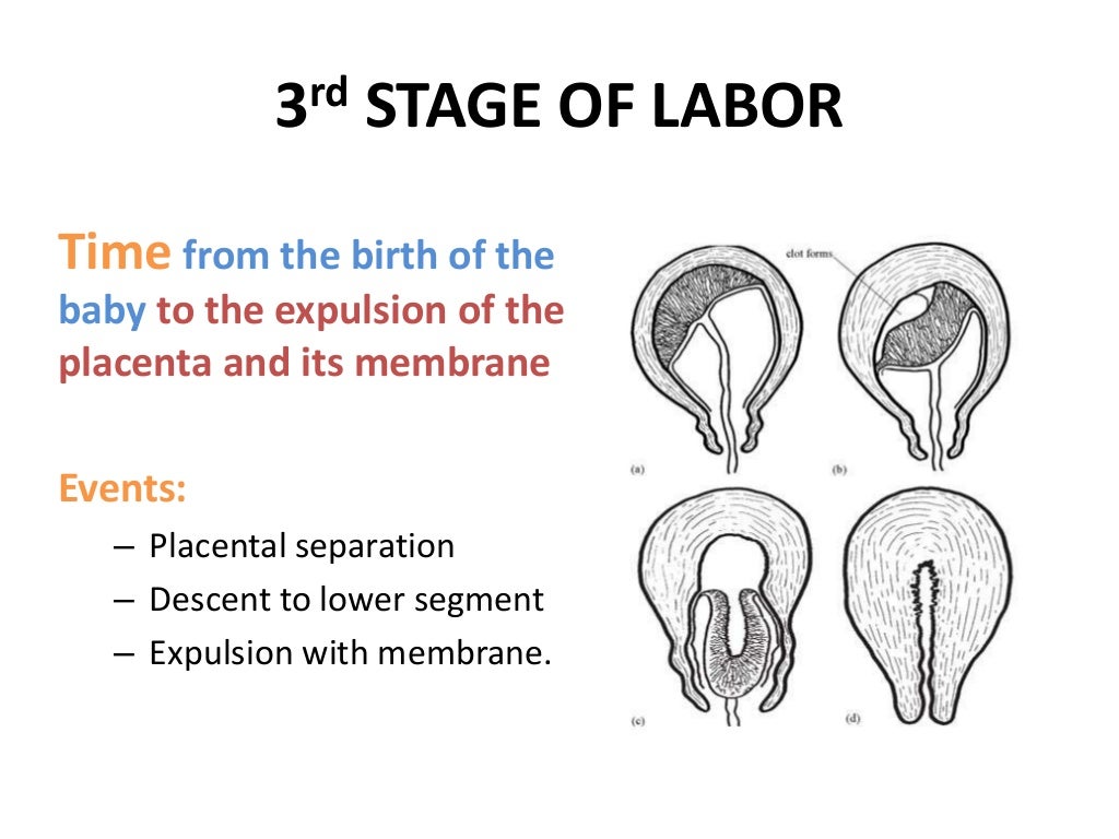 Complications of 3rd Stage of Labor