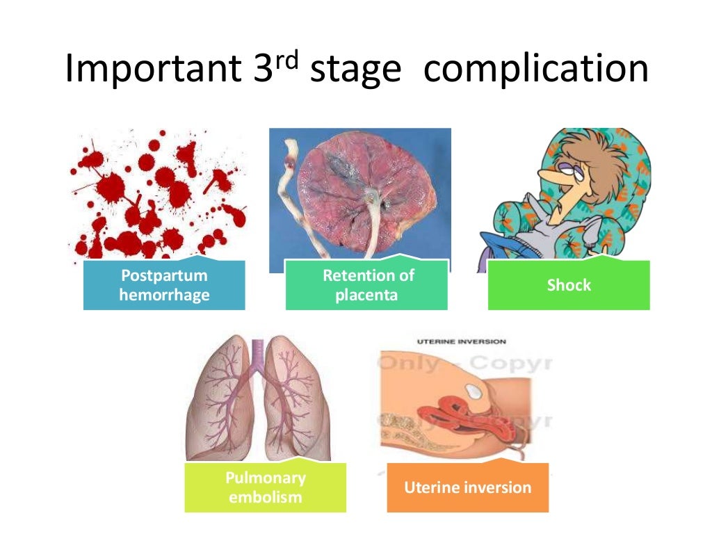 Complications of 3rd Stage of Labor
