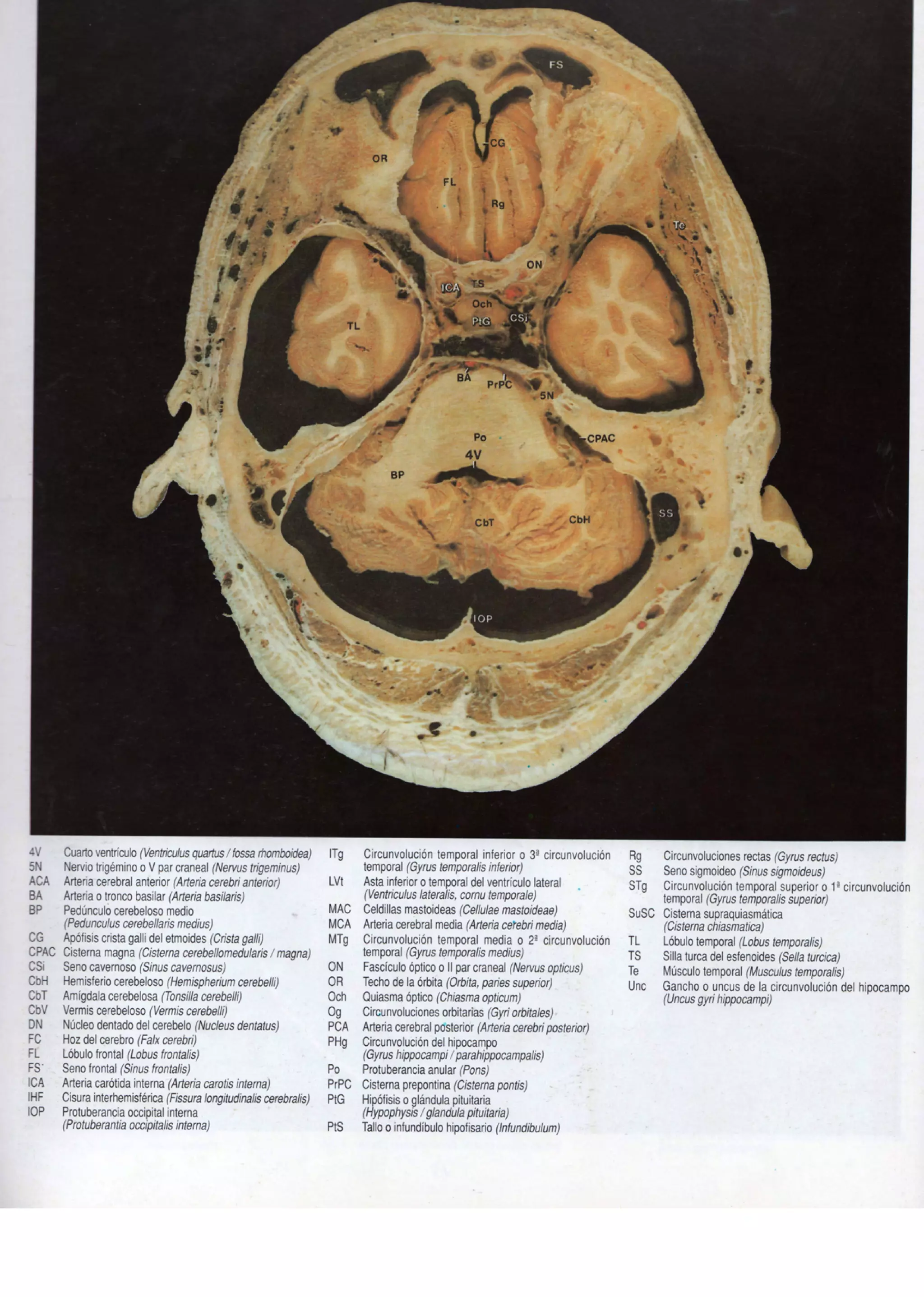 Han kim cortes anatomicos correlacionados con tac y rm - cabeza y ...