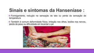slide com o tema da doença hanseníase em pdf | PDF