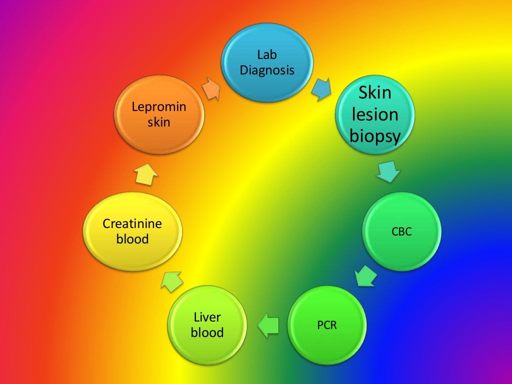 Hansen disease medical microbiology presentation by Ruth Naomi Manuel