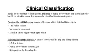 Hansens disease | PPT