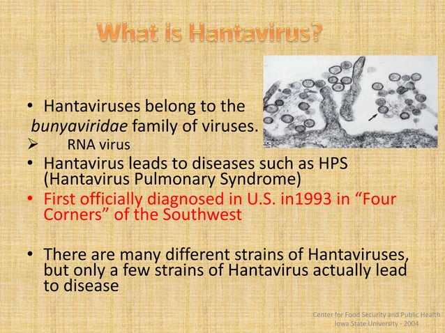 Hantavirus | PPTX