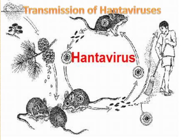 Hantavirus | PPTX
