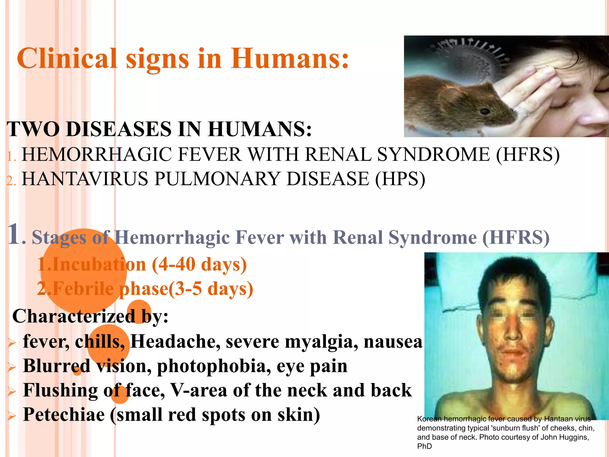Hantavirus as an emerging disease | PPTX