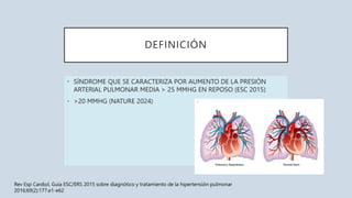 Hipertensión arterial pulmonar HAP. Manejo diagnóstico | PPTX