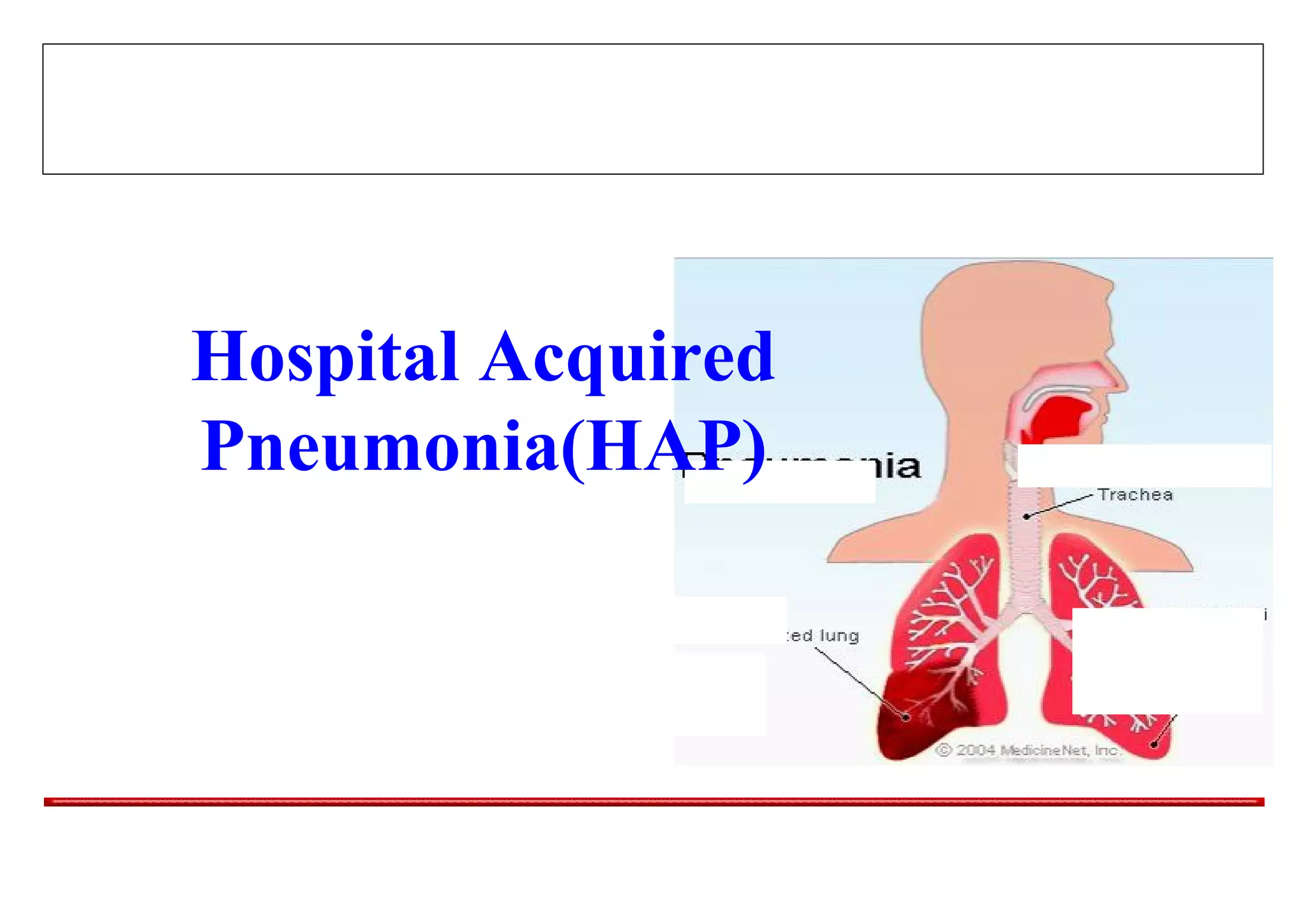 Hospital Acquired Pneumonia | PDF