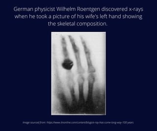 Then & Now: Radiology | PDF | Medical Tests | Medical Health