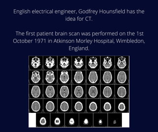 Then & Now: Radiology | PDF