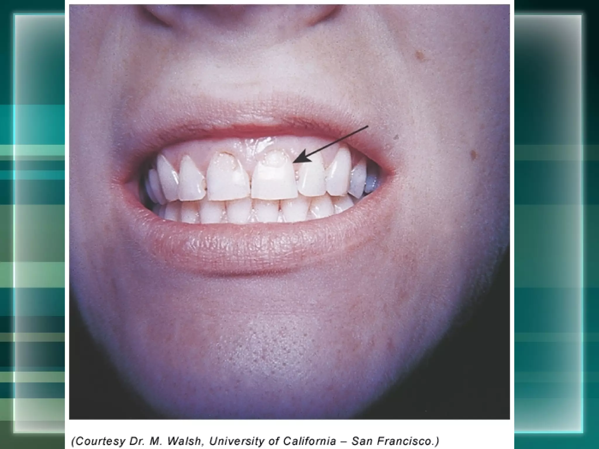 Hard Tissue Charting | PPT