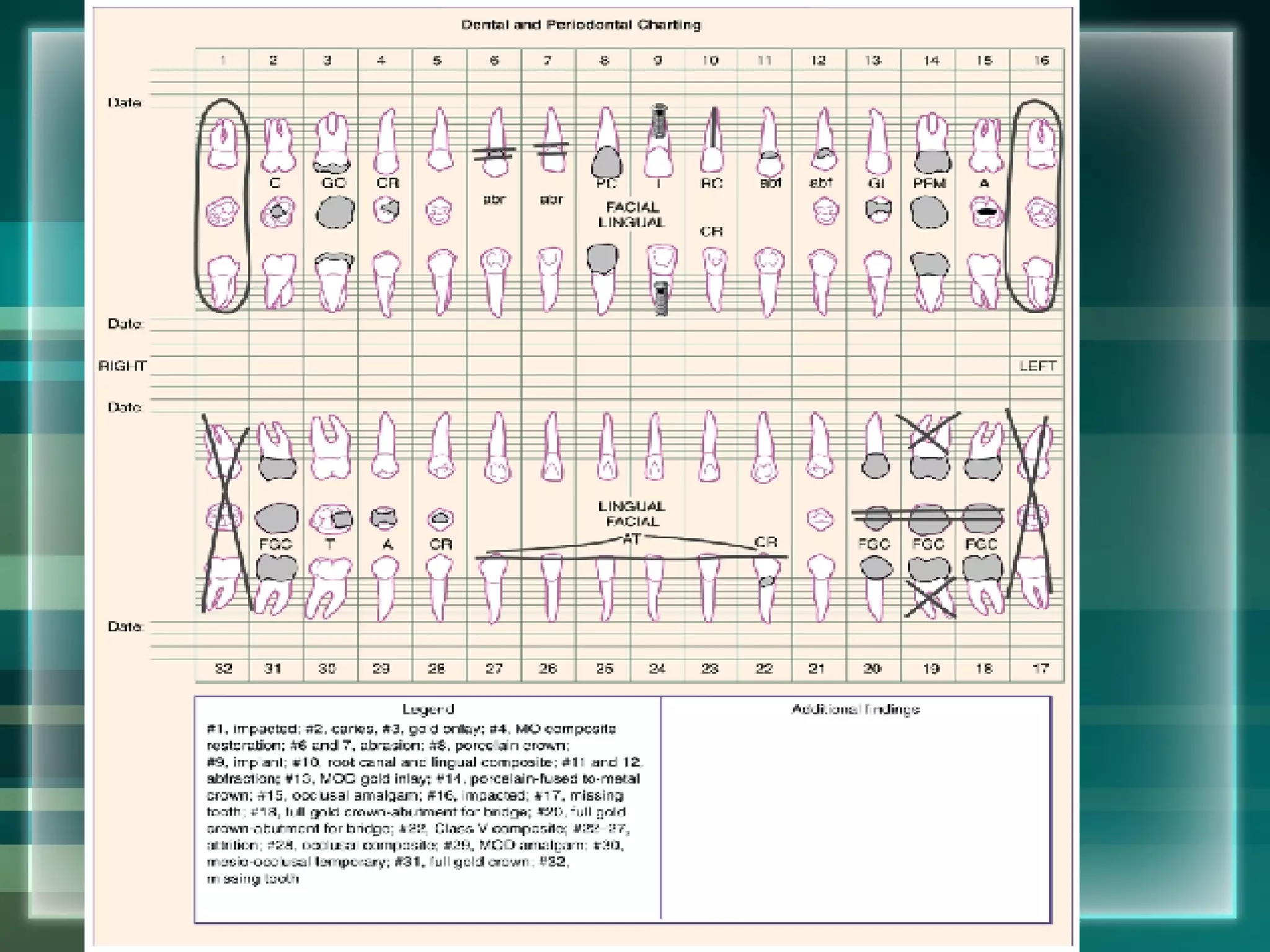 Hard Tissue Charting | PPT