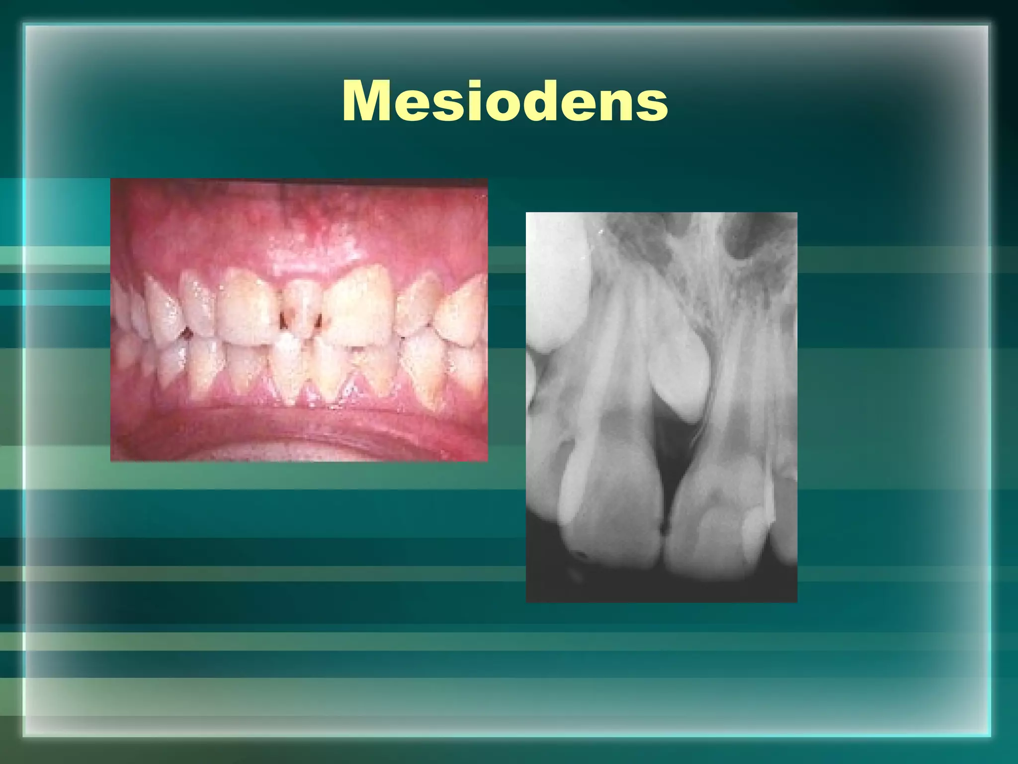Hard Tissue Charting | PPT