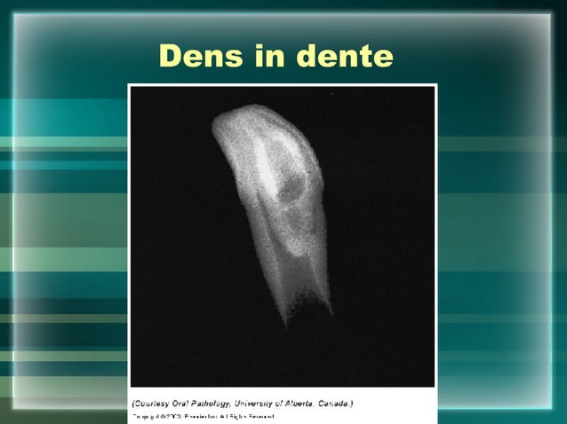Hard Tissue Charting | PPT | Dental Health | Diseases and Conditions